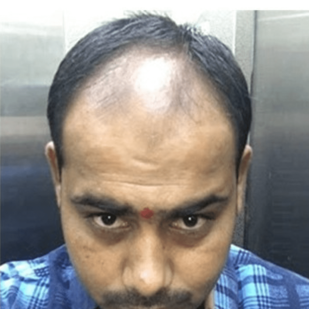 Gallery | Dr Viral Desai